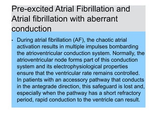 Irregular wide qrs tachycardia | PPT