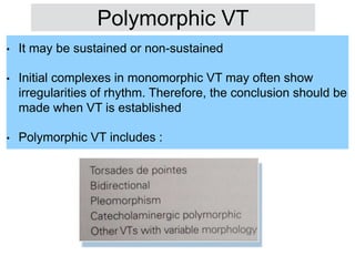 Irregular wide qrs tachycardia | PPT