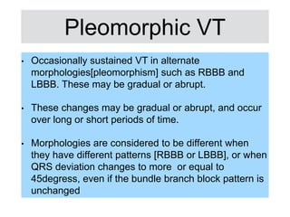 Irregular wide qrs tachycardia | PPT