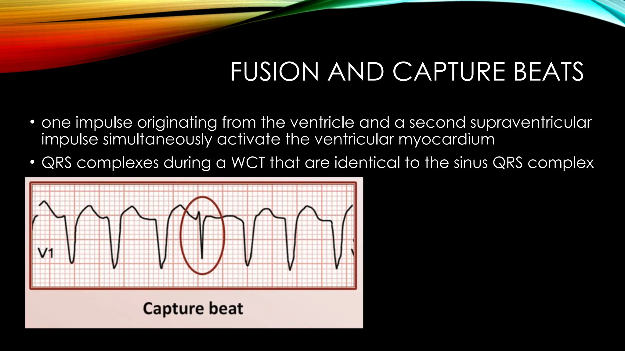 Wide QRS. Complex Tachycardia final.pptx