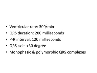 ECG: Wide QRS Tachycardia | PPT