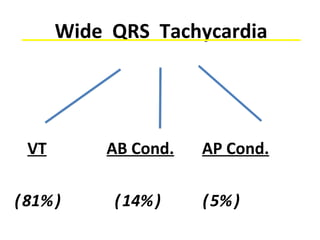 ECG: Wide QRS Tachycardia | PPT