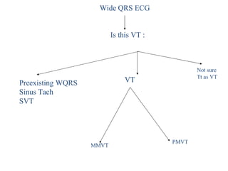 ECG: Wide QRS Tachycardia | PPT