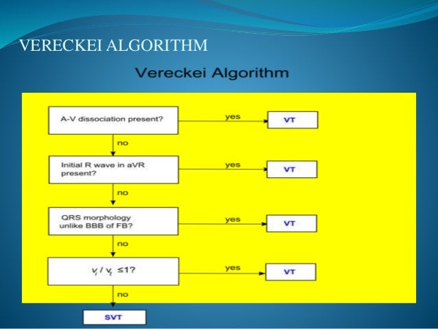 Wide complex Tachycardia by Dr. Vaibhav Yawalkar