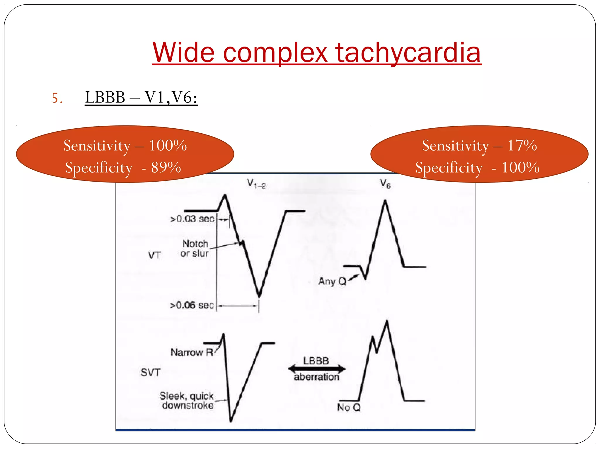 WIDE QRS TACHYCARDIA | PPT