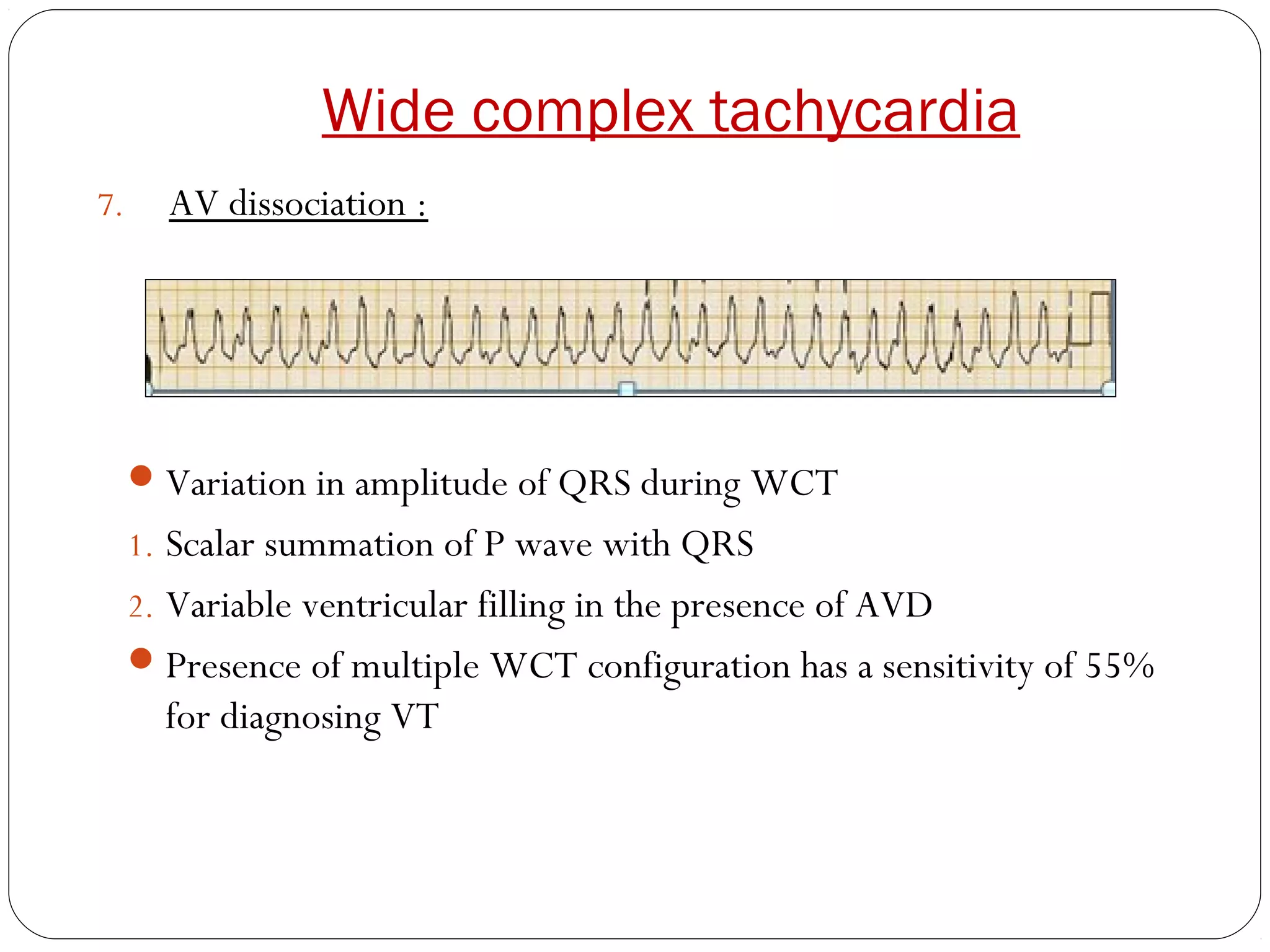 WIDE QRS TACHYCARDIA | PPT