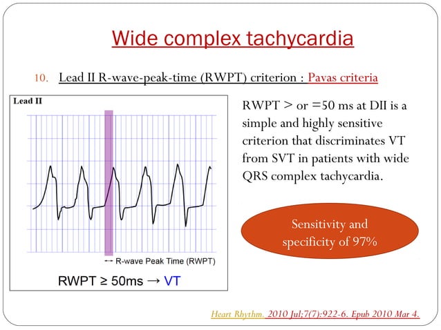 WIDE QRS TACHYCARDIA