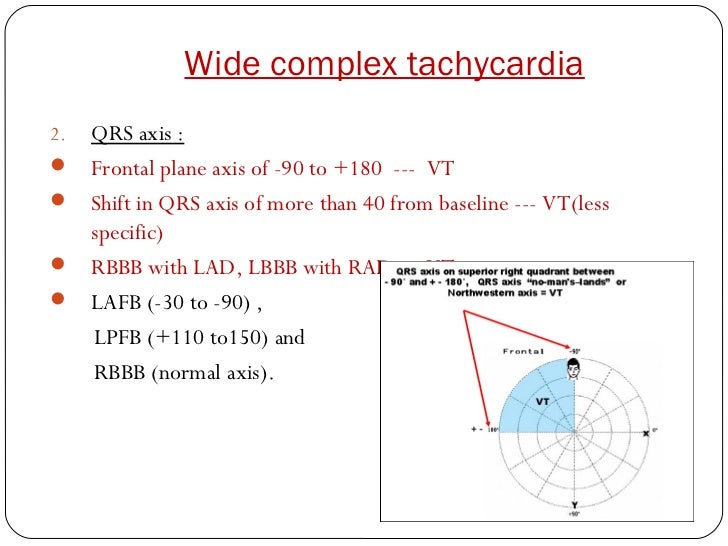 WIDE QRS TACHYCARDIA