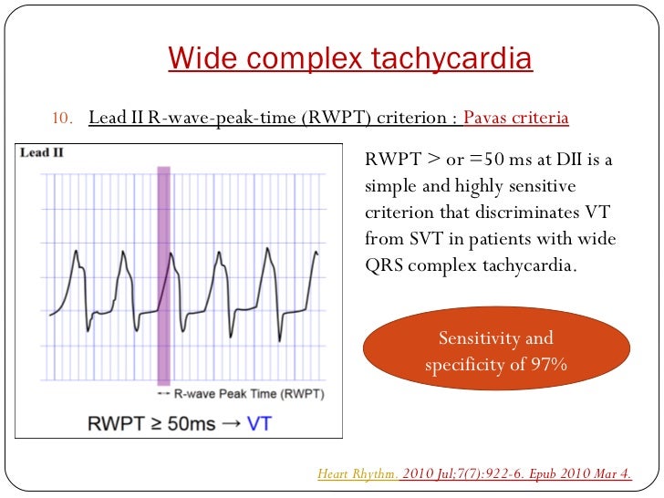 WIDE QRS TACHYCARDIA