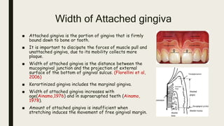 Width of attached gingiva | PPTX