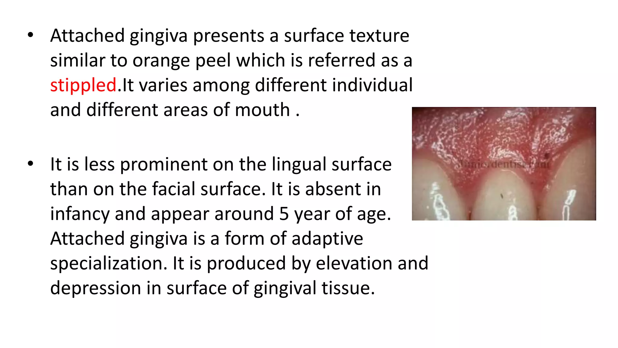 Width of attached gingiva and its significance | PPTX