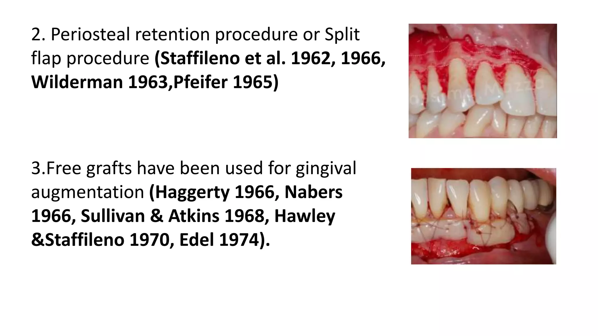 Width Of Attached Gingiva And Its Significance Ppt