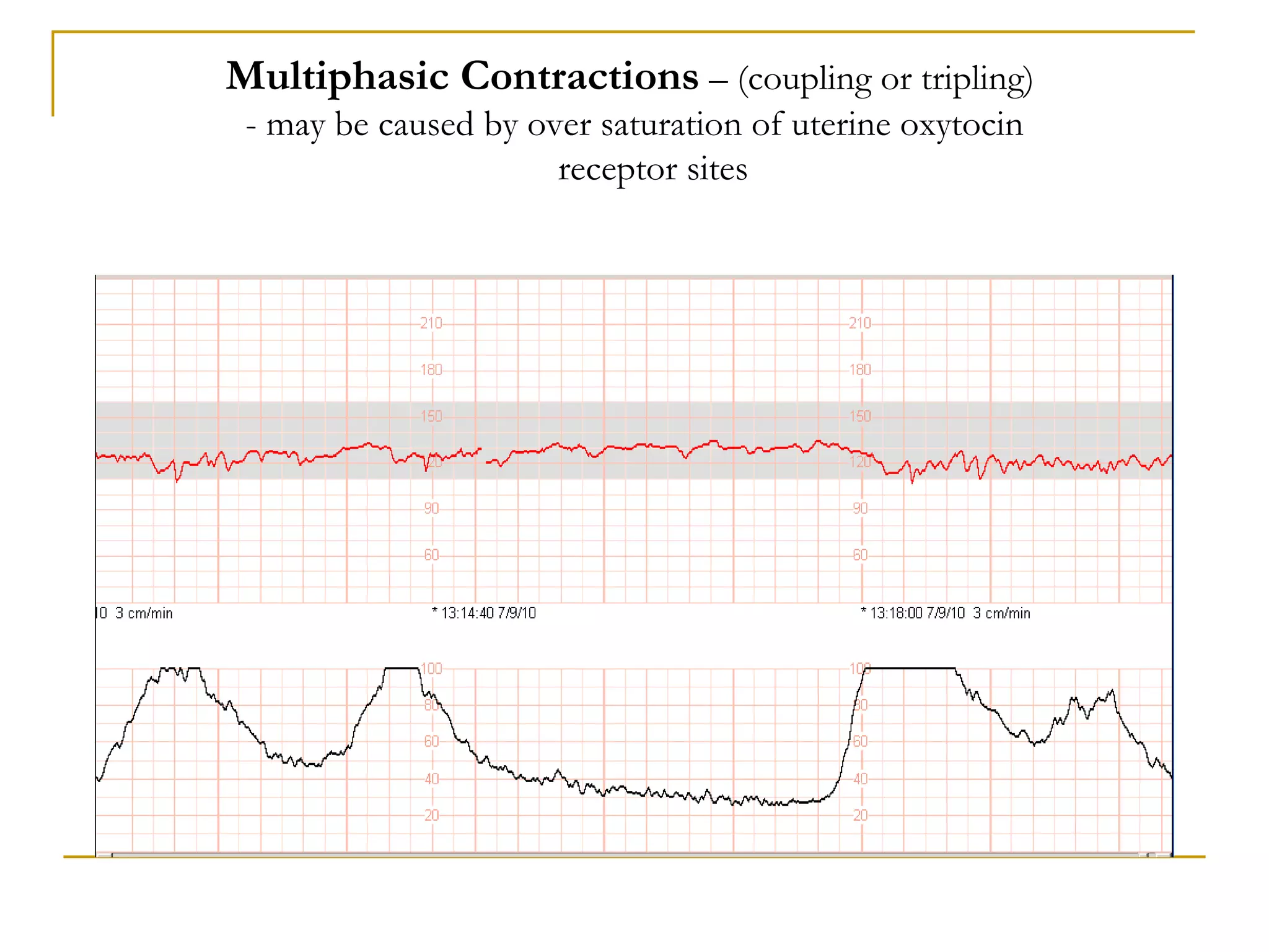 Wiki.assessment of uterine contractions 2011 | PPT