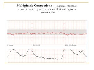Wiki.assessment of uterine contractions 2011 | PPT