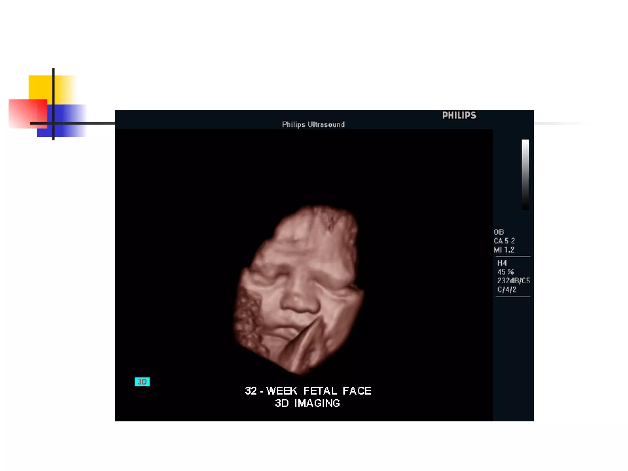 Wiki.diagnostic fetal assessment tests 2011 | PPT