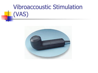 Wiki.diagnostic fetal assessment tests 2011 | PPT