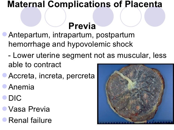 Placenta Complications Howstuffworks Combo With OB HTN And 7 Others