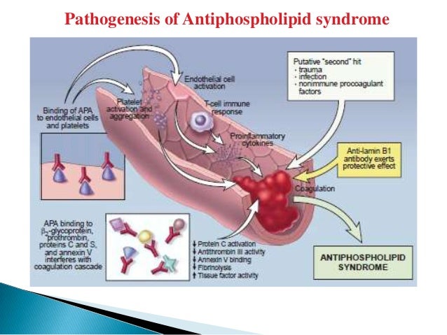 Antiphospholipid syndrome