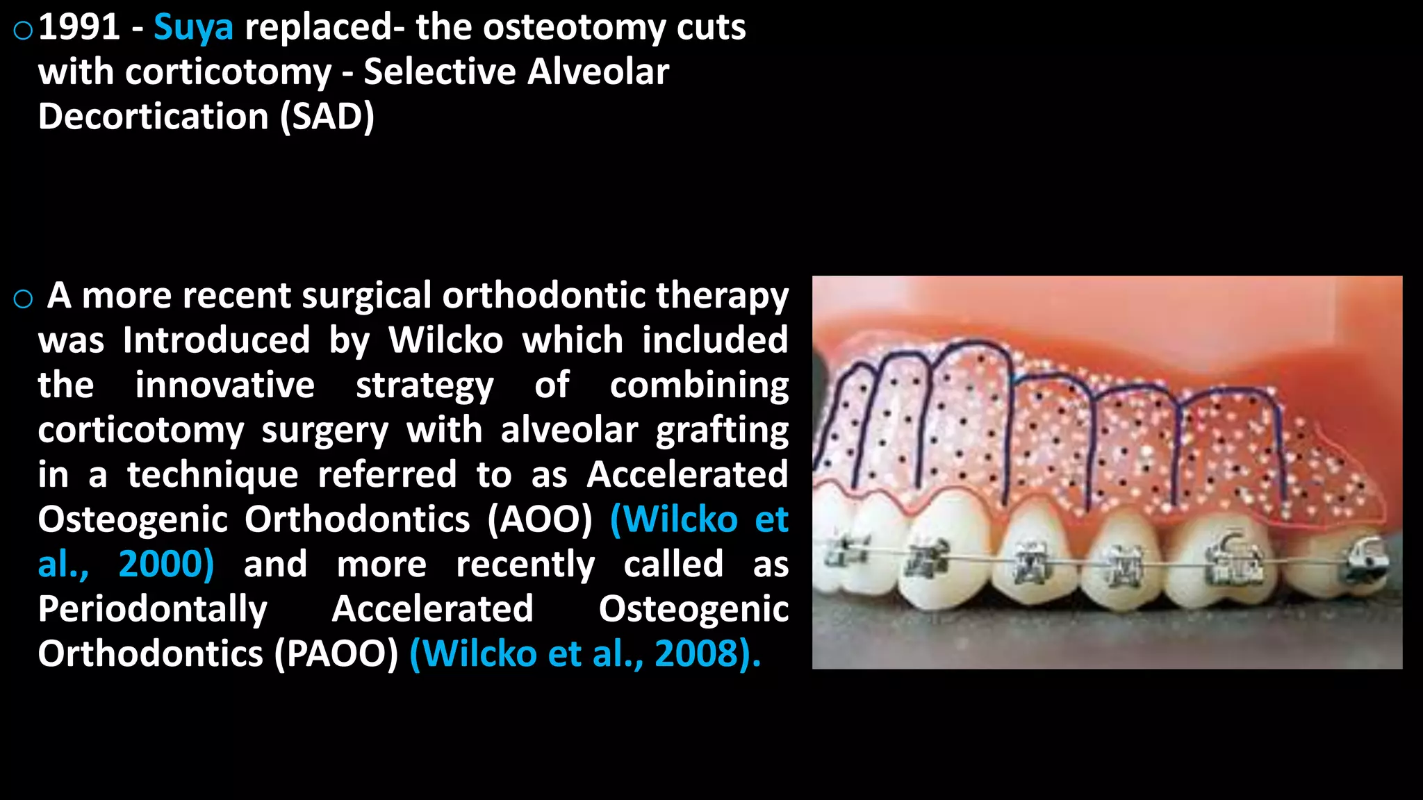 WILCKODONTICS | PPTX