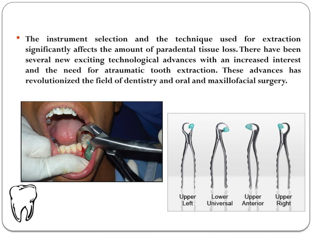 Wilckodontics and its importance in atraumatic tooth extraction | PPT