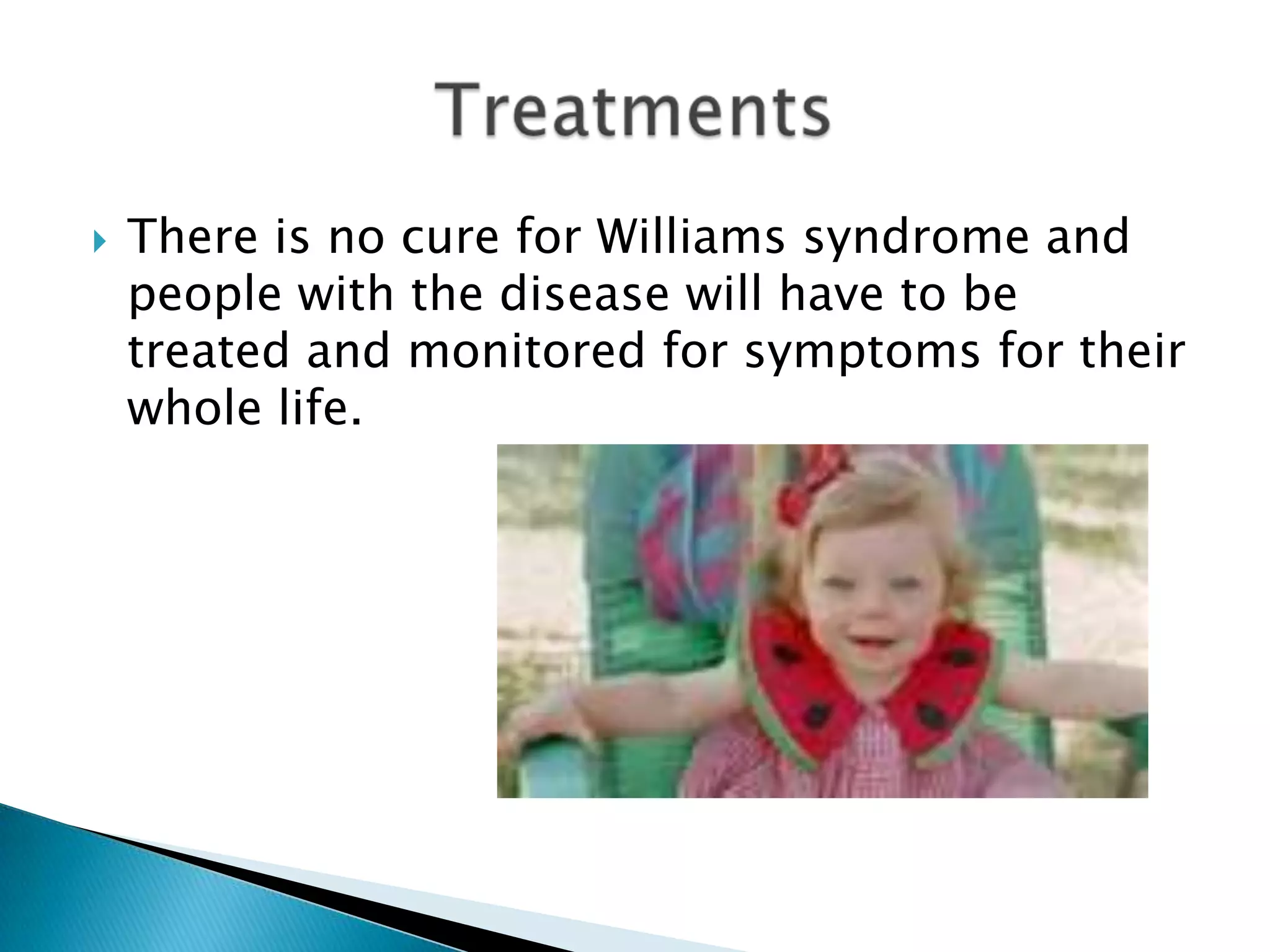 Williams Syndrome | PPTX