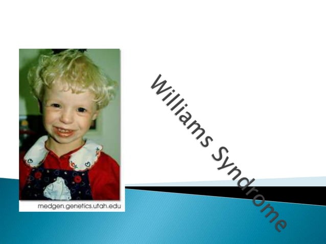 Williams Syndrome | PPTX | Children\'s Health | Healthy Living