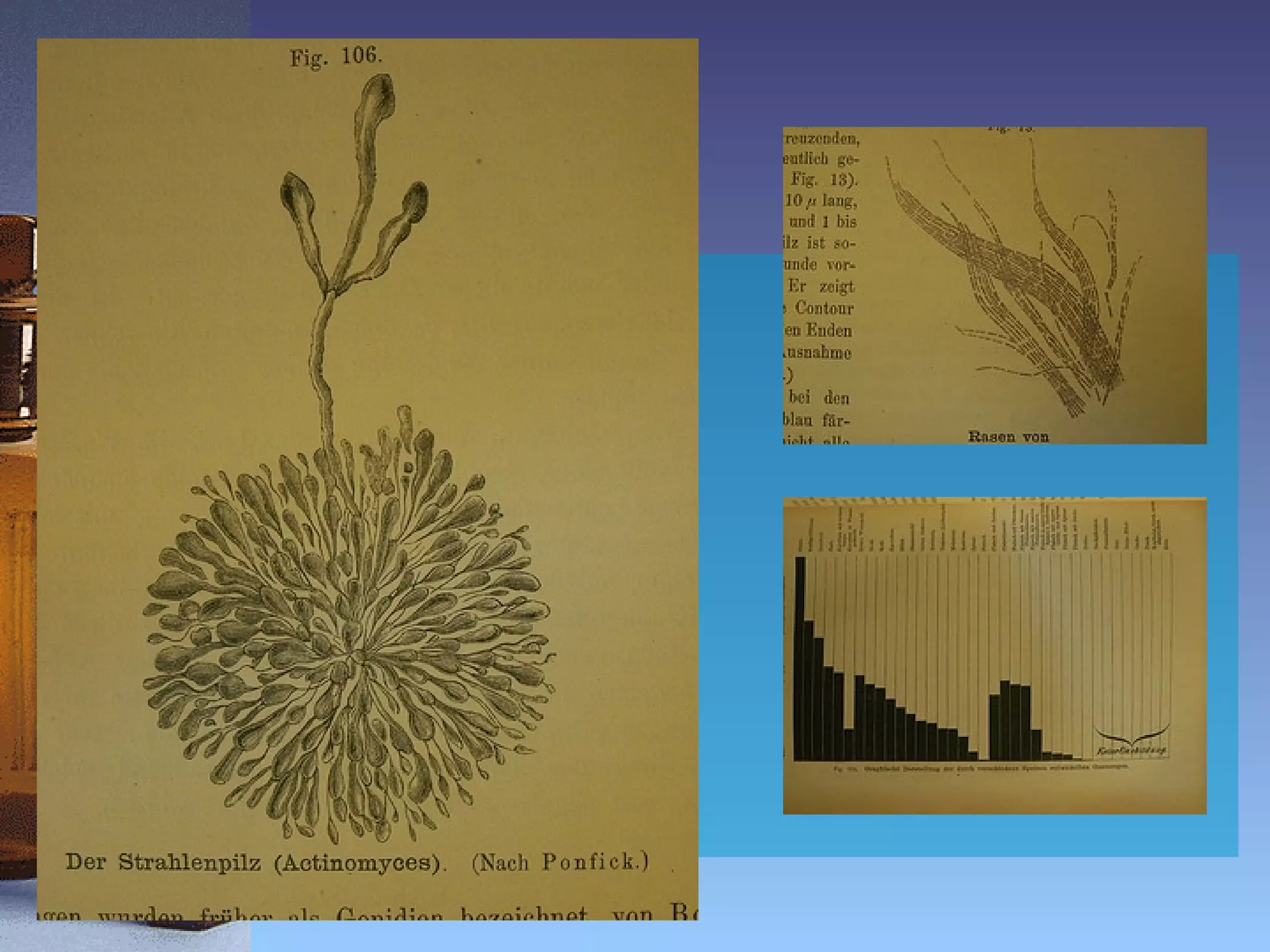 Willoughby D. Miller (1853-1907), Scientific Pioneer of Dentistry | PPT