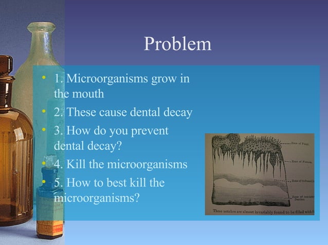 Willoughby D. Miller (1853-1907), Scientific Pioneer of Dentistry | PPT ...