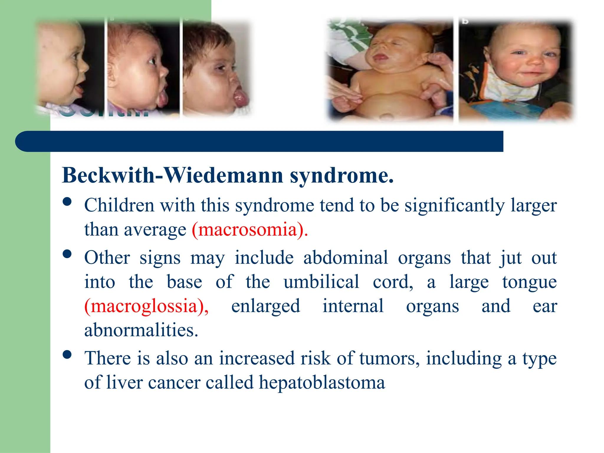wilms tumor is malignant renal tumors and most common | PPT