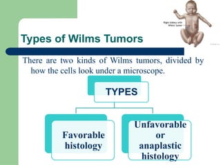 wilms tumor is malignant renal tumors and most common | PPT