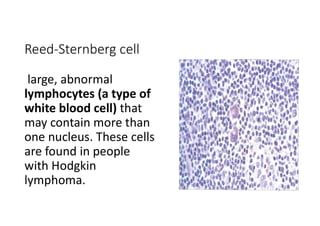Wilms tumor lymphoma abcdefgh klmno pytri | PPT
