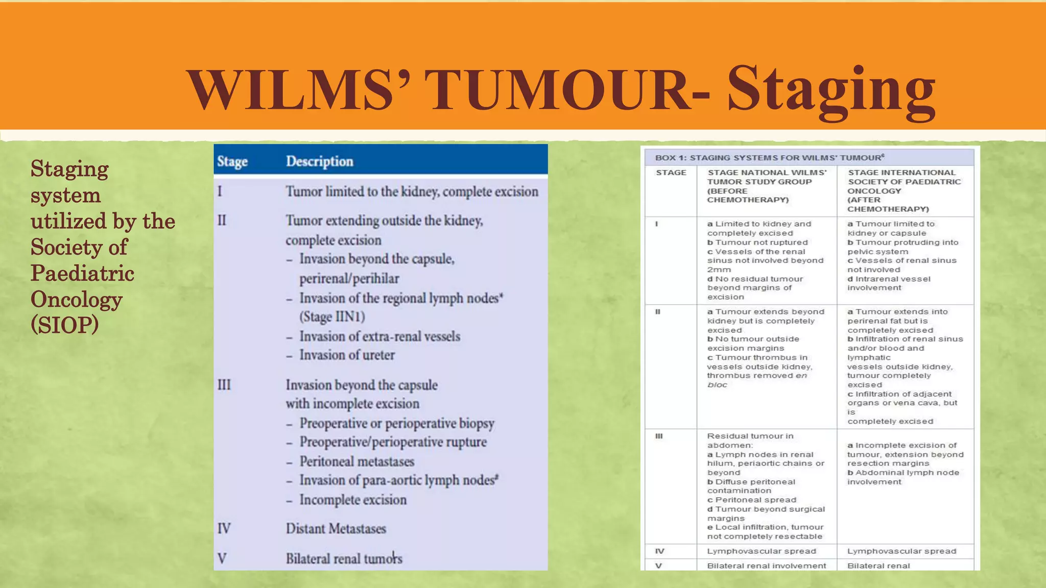 Wilms' tumour-- Pediatric Surgery | PPTX