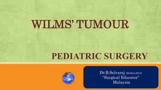 Wilms' tumour-- Pediatric Surgery | PPTX