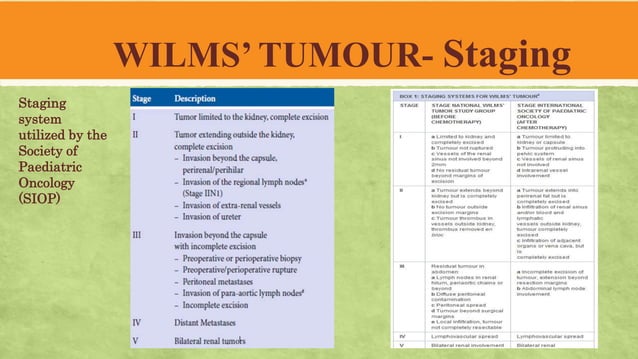 Wilms' tumour-- Pediatric Surgery | PPTX