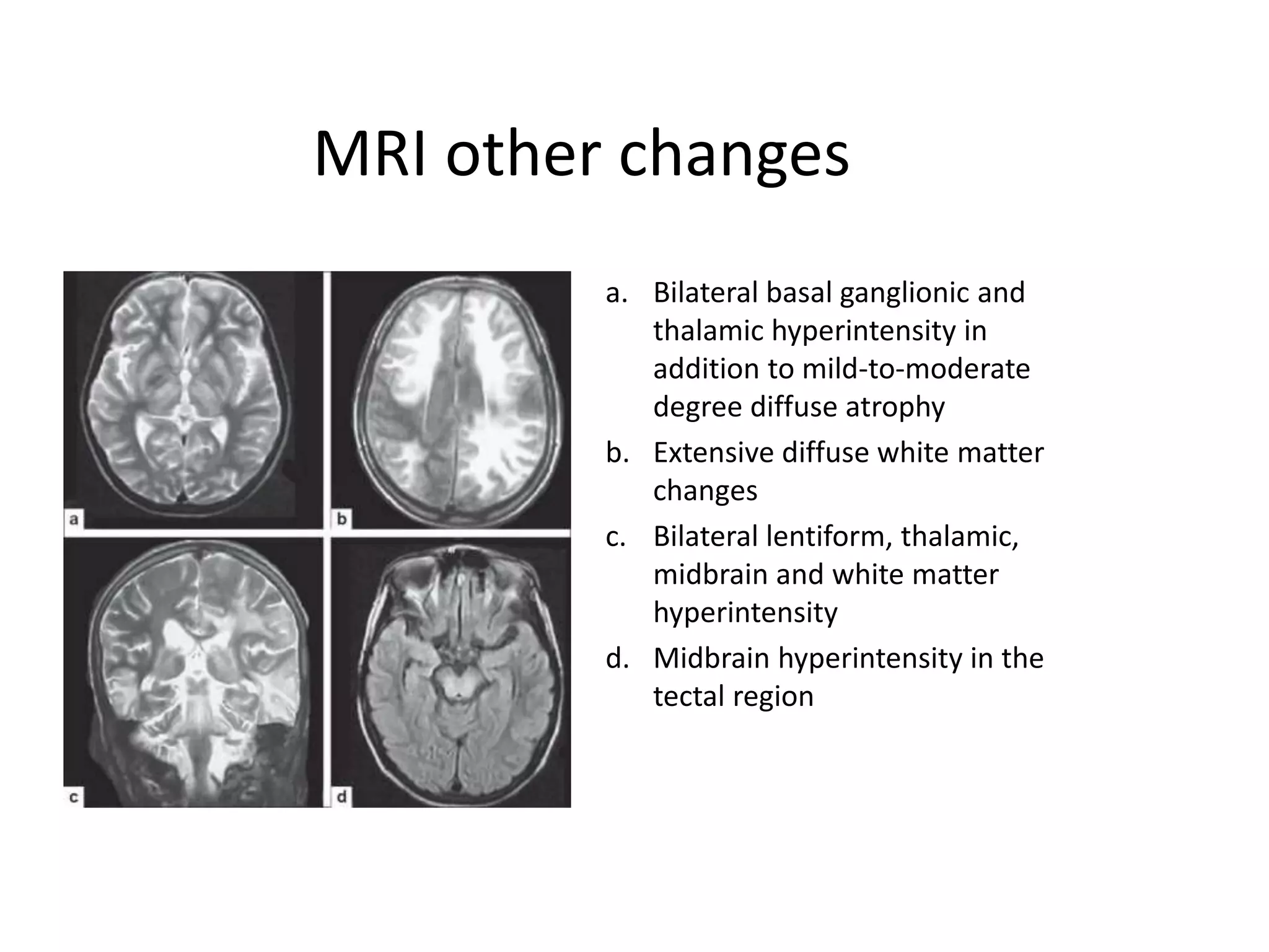 Wilson radiology | PPTX