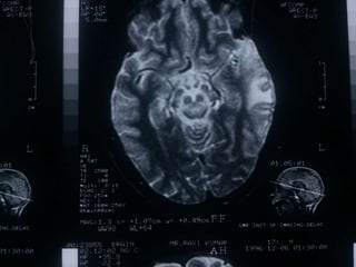 Wilson radiology | PPTX