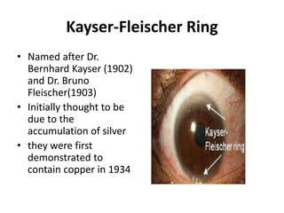 Kayser Fleischer Ring