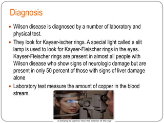 Wilson disease | PPTX