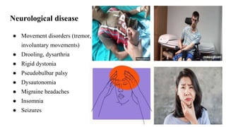 Wilson disease (Movement disorder).pptx | Brain and Nervous System ...