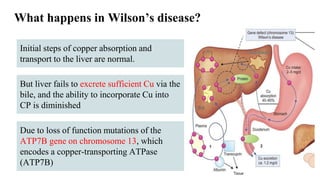 Wilson disease (Movement disorder).pptx | Brain and Nervous System ...
