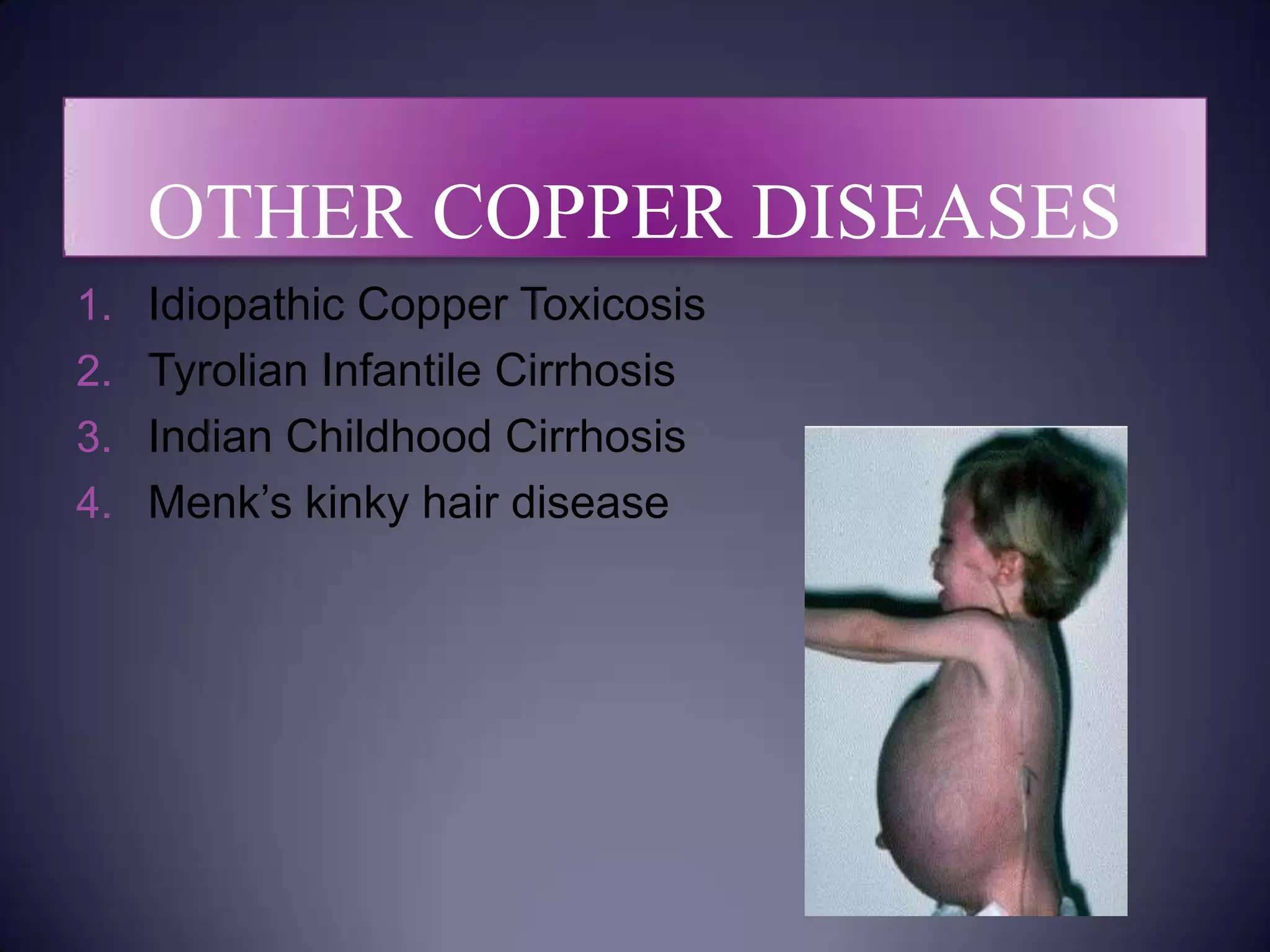 Wilson disease & general discussion on copper metabolism | PPTX