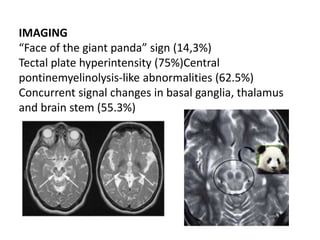 Wilsons and haemochromatosis | PPTX