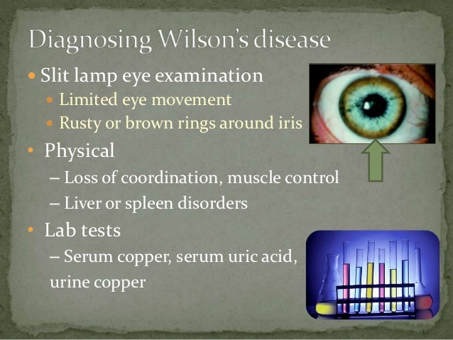 Wilson Disease