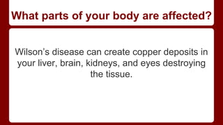 Wilson's disease (Copper disease) | PDF