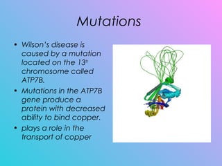 Wilson’s disease | PPT
