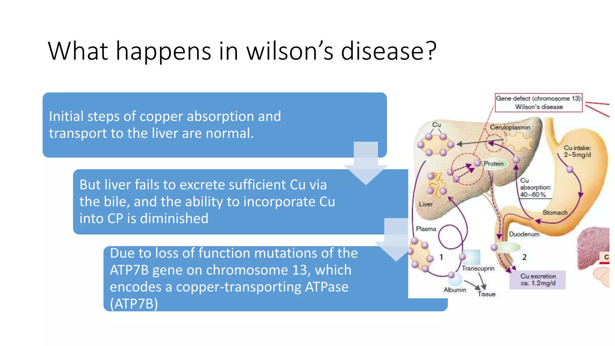 Wilson's disease (wilson) | PPTX