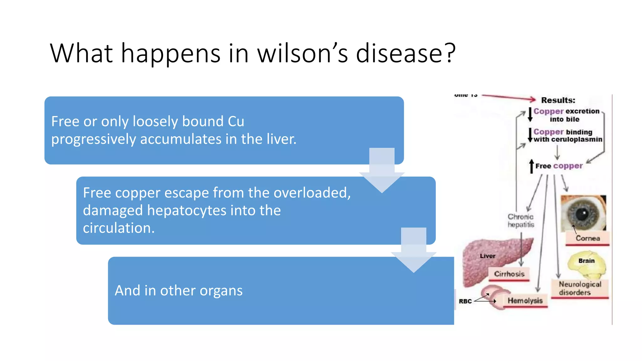Wilson's disease (wilson) | PPTX
