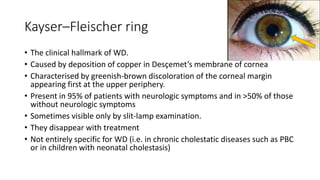 Wilson's disease (wilson) | PPTX