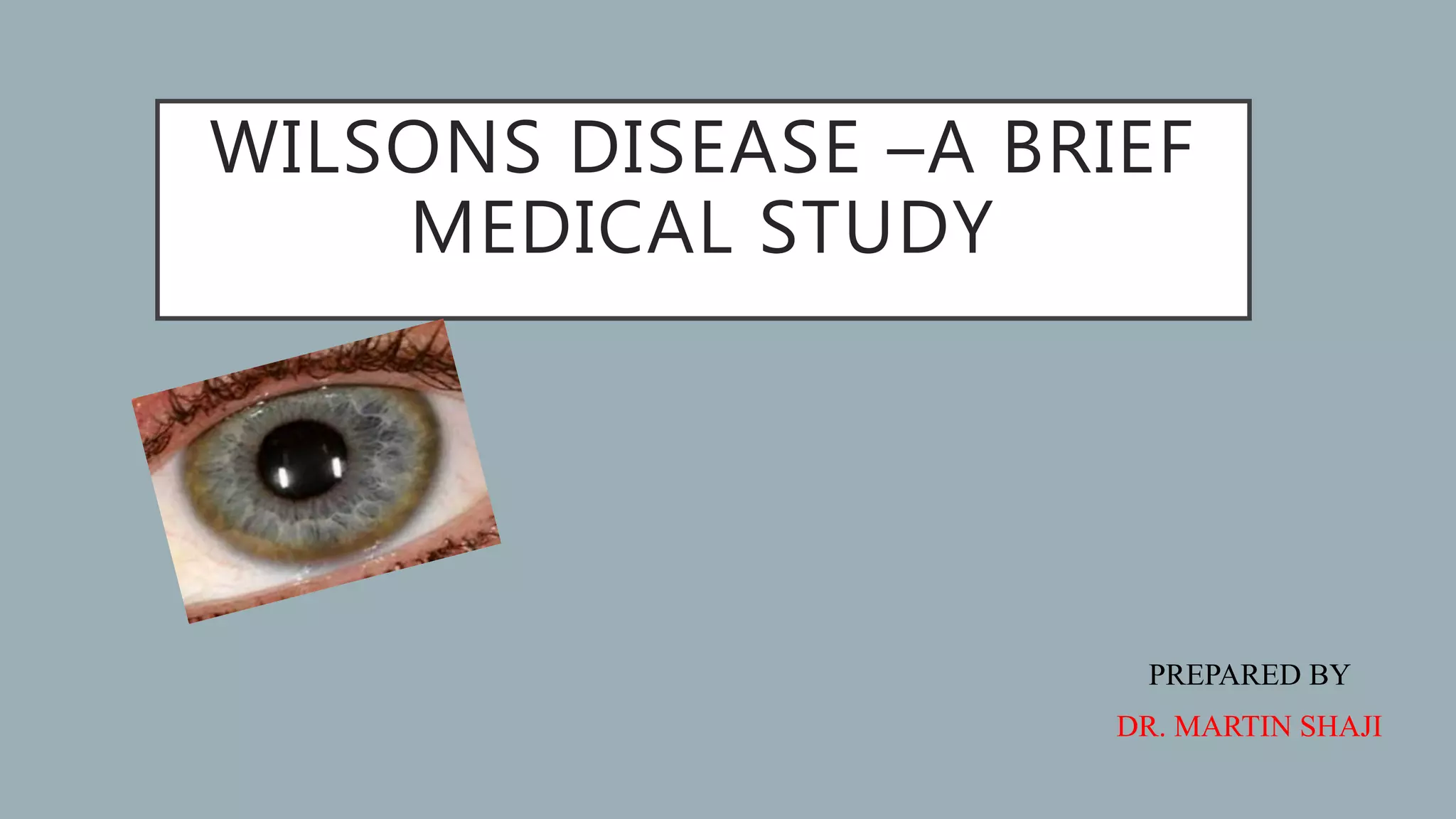 Wilsons disease- A brief medical study. | PPTX