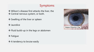 Wilsons disease- A brief medical study. | PPTX